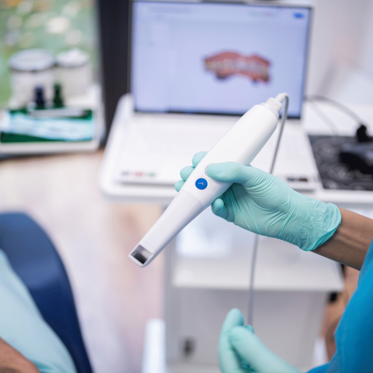 Choosing the Best Intraoral Scanner for 3D Printed Denture Workflows ...